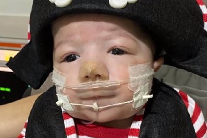 Saiba o que é Síndrome de Patau, doença que matou filho de Zé Vaqueiro