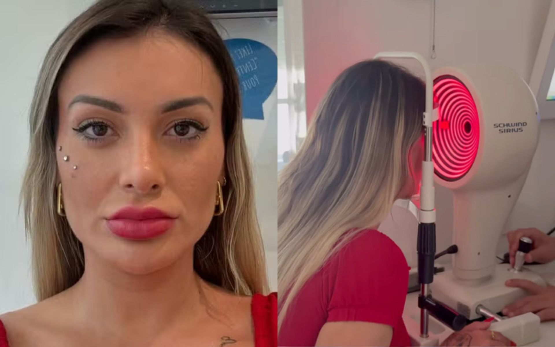 Andressa Urach faz cirurgia e muda cor dos olhos; confira