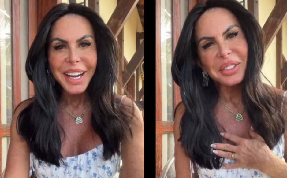 Gretchen aparece com rosto harmonizado e movimenta comentários